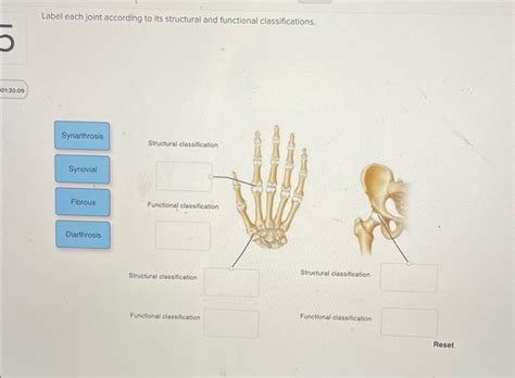 Solved Label Each Joint According To Its Structural And