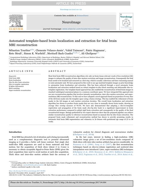 Pdf Automated Template Based Brain Localization And Extraction For