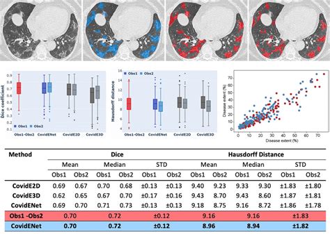 Comparison Between Automated And Manual Segmentations Delineation Of Download Scientific