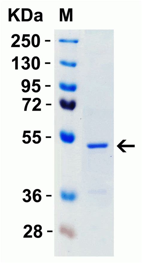 Recombinant Sars Cov 2 Nucleocapsid Protein Lambda Variant T366i
