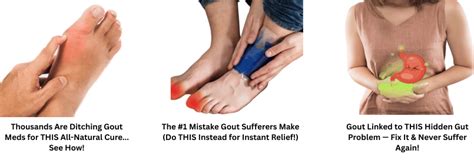 Your Ultimate Guide To Anti Gout Medication Essential List Of