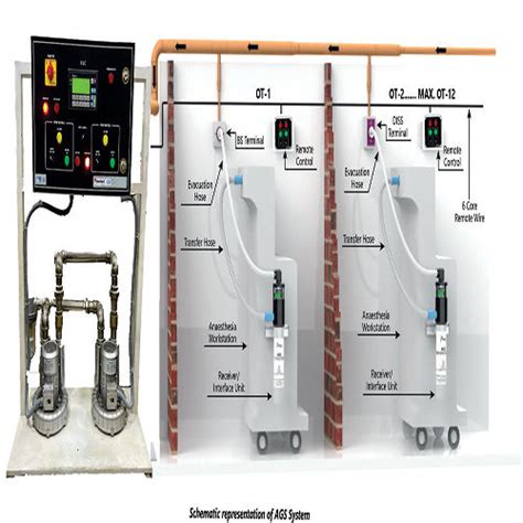 Agss Setup At 150000 00 Inr In Delhi Delhi Mediline Engineers Pvt Ltd