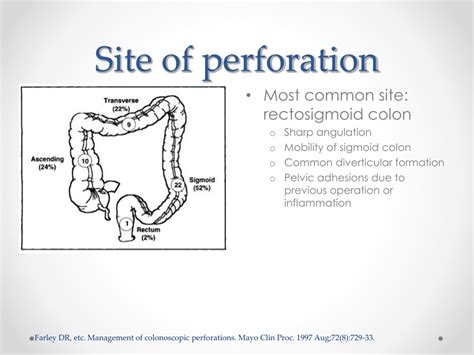 Ppt Management Of Colonoscopic Perforation Powerpoint Presentation