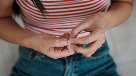 Itchy Palms 6 Causes Treatment And Prevention The Sarcoptic Mange Of