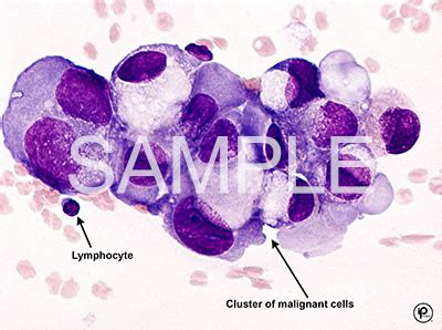 Body Fluid Image Atlas Single User Download