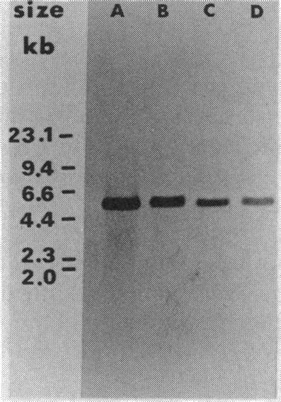 Southern Hybridization Of Chromosomal Dna Prepared From Staphylococcal