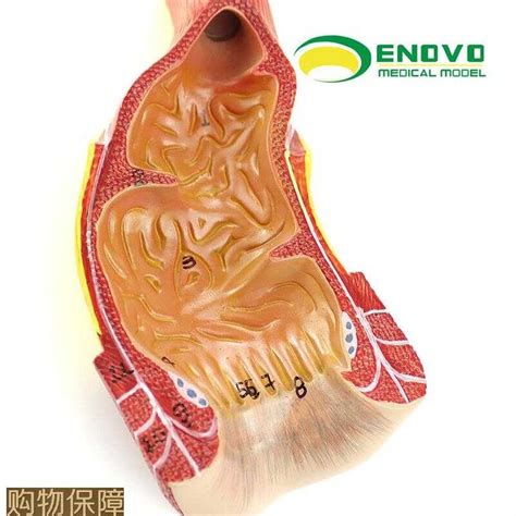Enovo Medical Anatomy Model Of Human Rectum Anal Canal Anal Structure