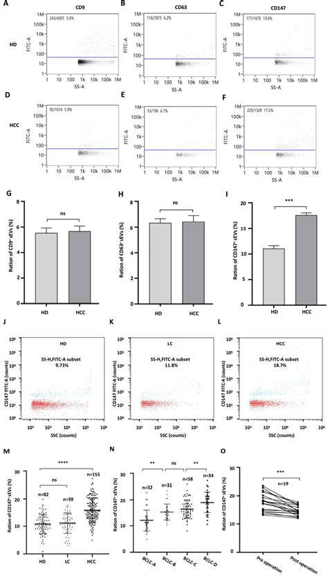 Hepatocellular Carcinoma Cell Derived Small Extracellular Vesicle