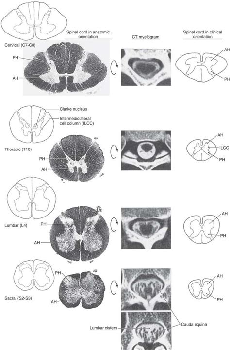 Spinal Cord Cross Section Cervical Cross Sectional Anatomy Of The