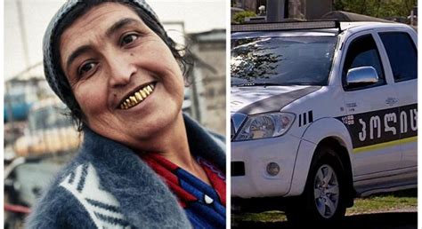 კახელ ქალს ბალიშის ქვეშ შენახული ოქროს კბილები მოპარეს