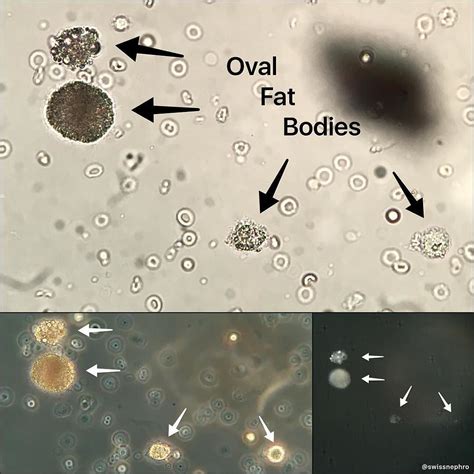 Pin On Urine Microscopic