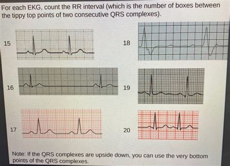 Solved For Each Ekg Count The Rr Interval Which Is The