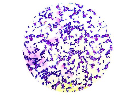 120 Staphylococcus Saprophyticus Fotos Fotos De Stock Imagens E Fotos Royalty Free Istock 120 Staphylococcus Saprophyticus Fotos Fotos De Stock Imagens E Fotos Royalty Free Istock