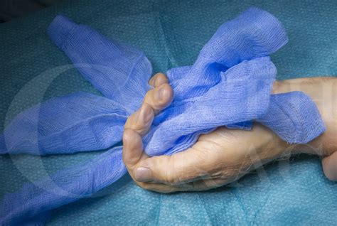 Technique Dupuytrens Contracture Palmar And Digital Fasciectomy Luanmd