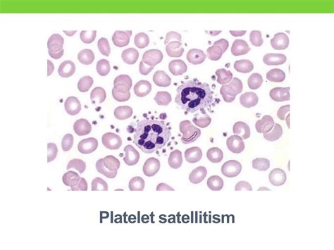 Pbs Fields Staining Convertedpdf