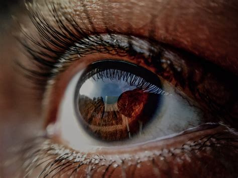 Home Page Iris And Retina