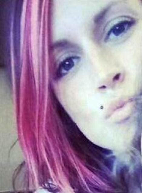 Audree Kopp Biography American Woman Caught Infection From Hair Tie