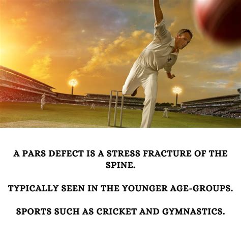 Pars Defect And The Impact On Younger Cricket Bowlers And Gymnasts Hallamshire Physiotherapy
