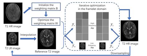 Multi Modal Brain Mri Images Enhancement Based On Framelet And Local Weights Super Resolution