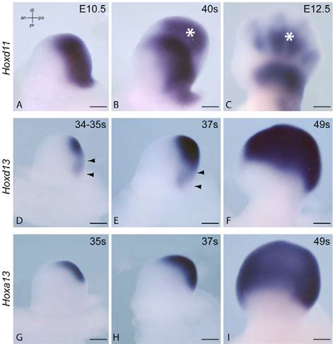 Figure 1 From The Apical Ectodermal Ridge Is A Timer For Generating