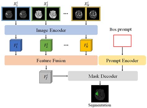 Segmentation Of Brain Tumors Using A Multi Modal Segment Anything Model