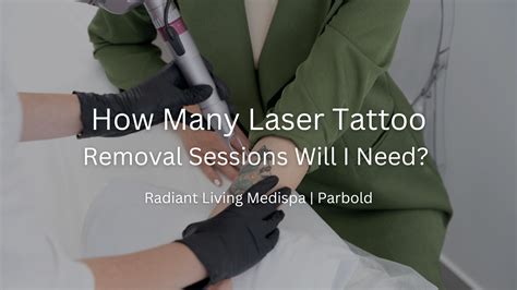 How Many Laser Tattoo Removal Sessions Skin And Laser Clinic