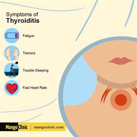 Thyroid Swelling Clinically Discrete Swellings Of Thyroid Gland