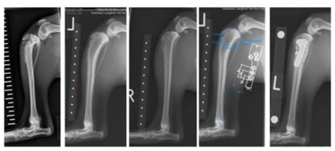 13 Tibia And The Tarsus Flashcards Quizlet