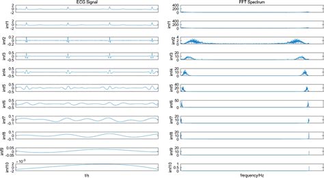 Accurate Authentication Based On Ecg Using Deep Learning Liping Zhang Shukai Chen Wei Ren