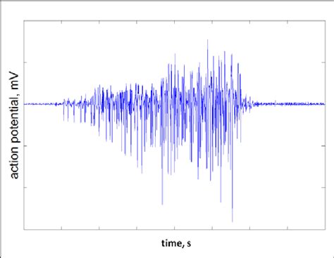 18 Illustration Of An Emg Interference Pattern Download Scientific