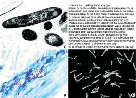 Mycobacterium Leprae Morphology 2 Download Scientific Diagram