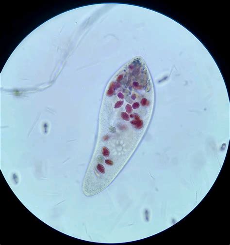 Paramecium Microscope Photo Paramecium Caudatum