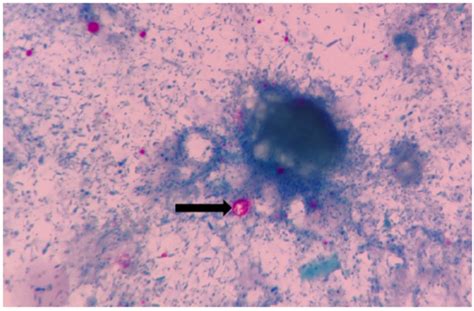 Oocyst Of Cryptosporidium Under 400 X Magnification [modified Zn Download Scientific Diagram