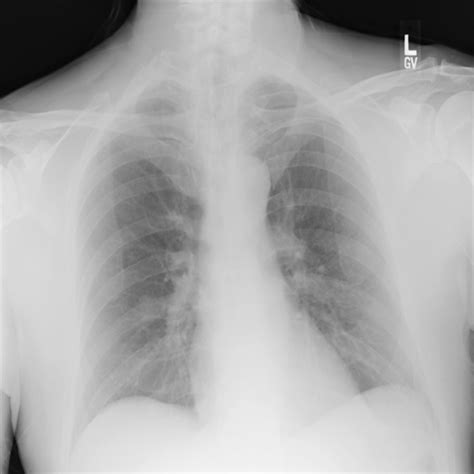 Image Masking Tool Roboflow Universe