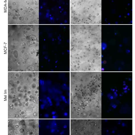 Representative Phase Contrast And Fluorescence Pictures Of The Cell