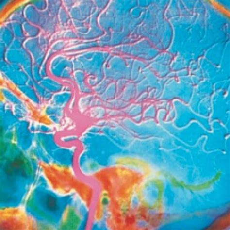 Alexandra Le Clere Sigmund Freud University Vienna Vienna Sfu