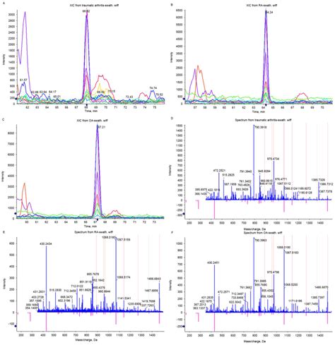 Synovial Fluid Analysis Chart Ponasa