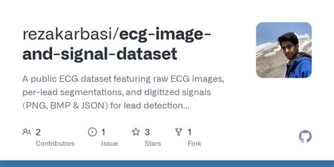 Ecg Image And Signal Dataset Make Dataset Py At Main · Rezakarbasi Ecg