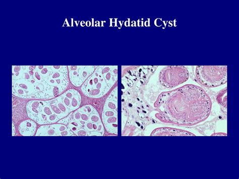Ppt Echinococcus Granulosus Powerpoint Presentation Free Download