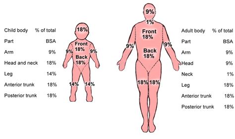 Sci Study Time Rule Of Nine And Burns Burns Nursing Physical Therapy