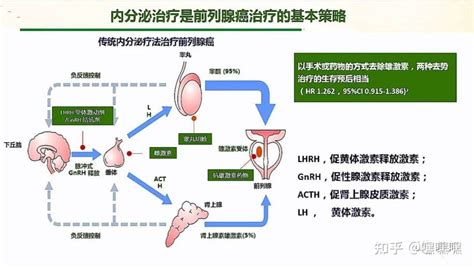 E10b治疗晚期去势抵抗性前列腺癌研究新进展 知乎