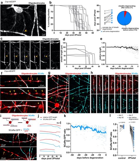 Myelin Sheath Degeneration Occurs Via Distinct Phases Of Retraction