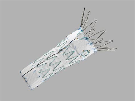 Zenith® Fenestrated Aaa Endovascular Graft Proximal Body Grafts Cook