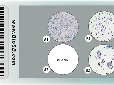 Tissue And Cell Line Microarrays