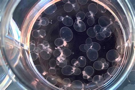 How To Extract Csf Like Fluid From Choroid Plexus Organoids