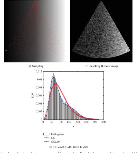 Figure 9 From A Generalized Gamma Mixture Model For Ultrasonic Tissue