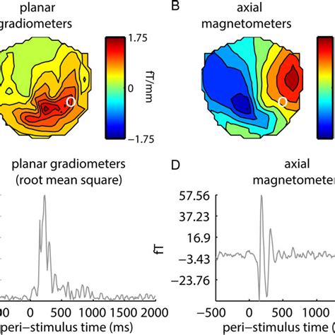 amplitude components of sensor space evoked responses interpolated