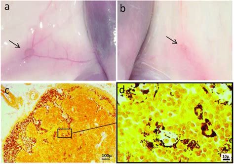 Distribution Of Melanin In Draining Lymph Nodes Macroscopic Aspect Of