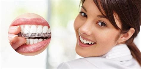 5 Things People With Great Teeth Always Do Raffles Dental Singapore