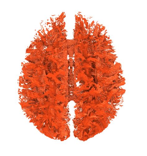 Streamlines Tractography Output Problem Mrtrix3 Community